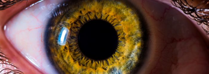 Emianopsia omonima: cosa è e chi colpisce? - Oculista Italiano