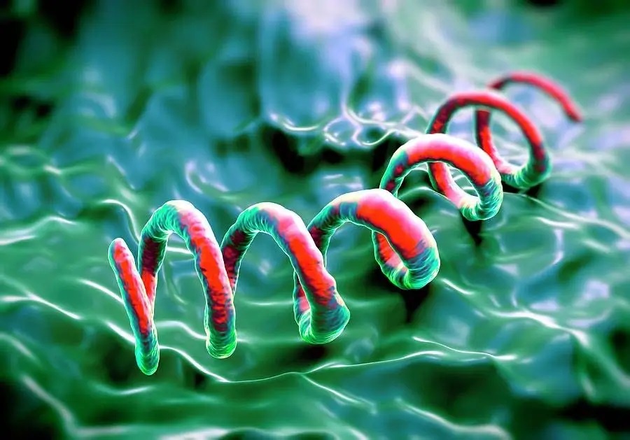 Sifilide oculare e diagnosi precoce - Oculista Italiano